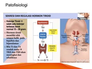 Hipotiroid_Kongenital_Pelatihan_SHK_fini.pptx