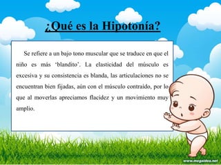 hipotonia en niños. maria ron.pptx