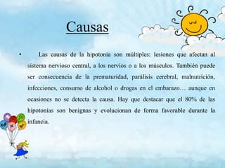 hipotonia en niños. maria ron.pptx