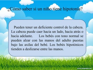 hipotonia en niños. maria ron.pptx