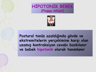 Hipotonik bebek(fazlası için www.tipfakultesi.org) | PPT