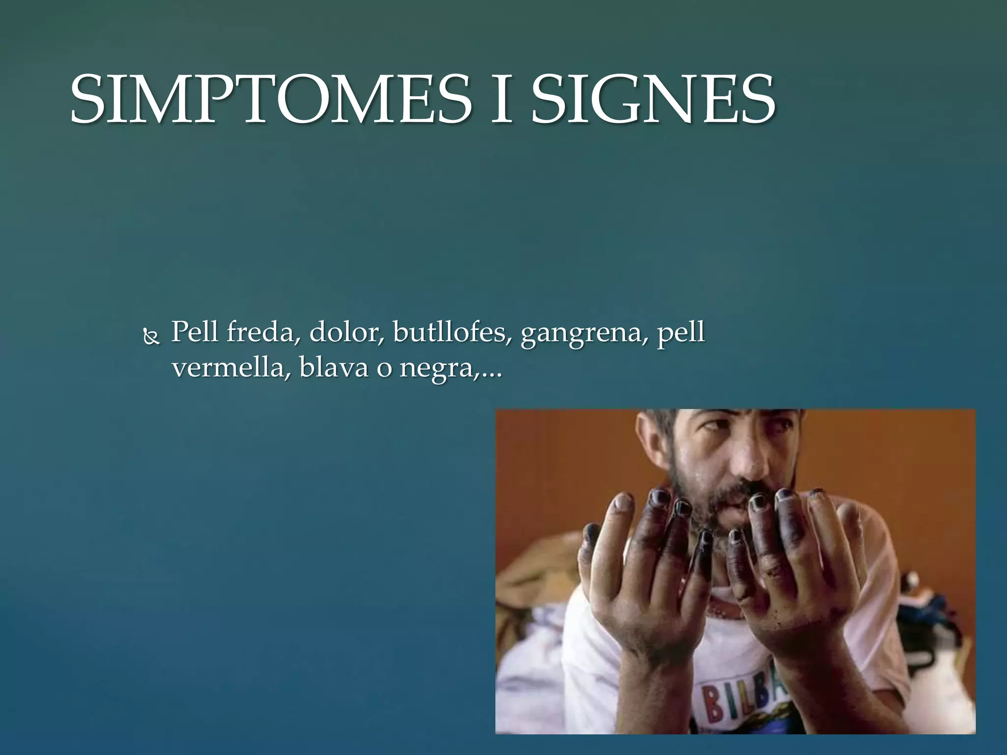 Hipotèrmia i congelacions | PPTX