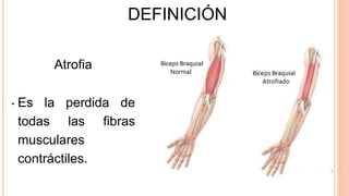 Hipotrofia y atrofia | PPTX