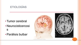 Hipotrofia y atrofia | PPTX