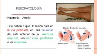 Hipotrofia y atrofia | PPT