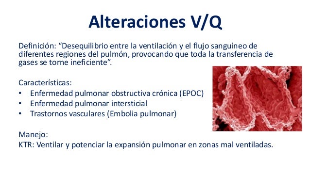 Hipoxemia y sus causas