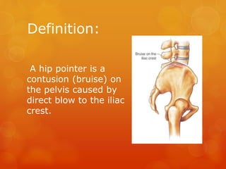 Hip pointer presentation em and holly[1] | PPTX