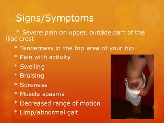 Hip pointer presentation em and holly[1] | PPTX