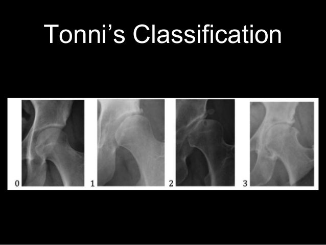 Whats New in Hip Preservation Surgery?