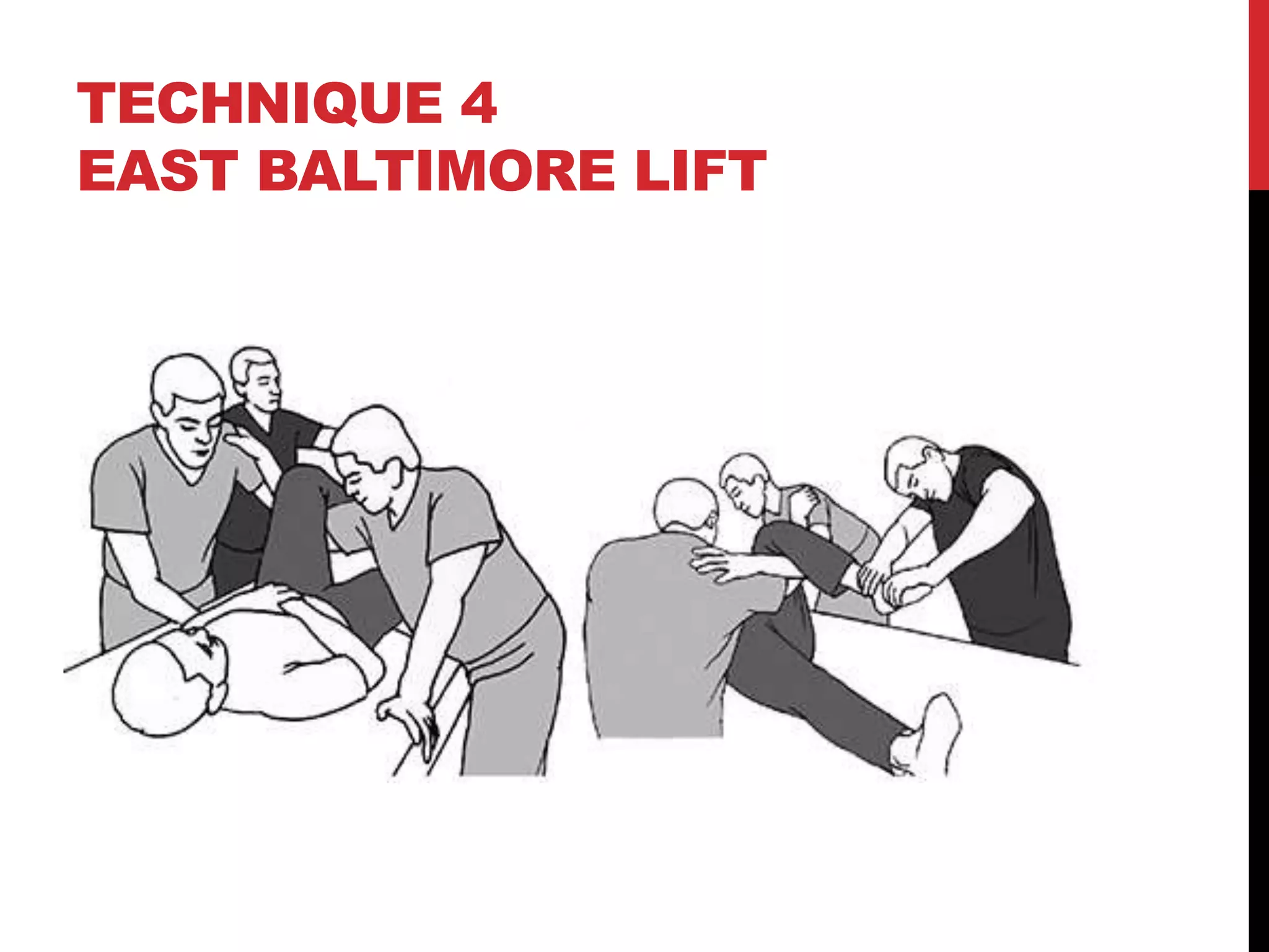 Hip Reduction Techniques | PPTX