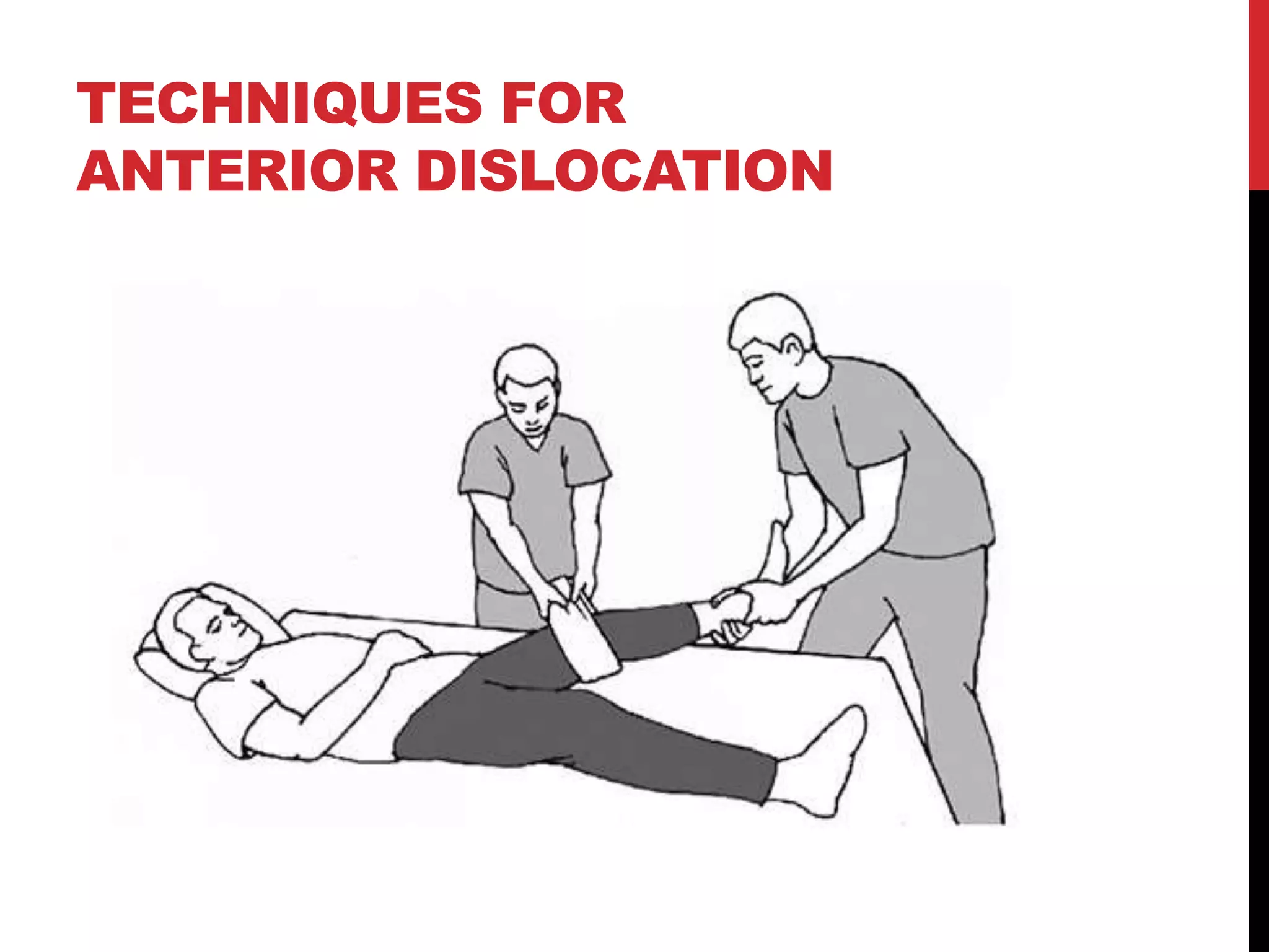 Hip Reduction Techniques | PPTX