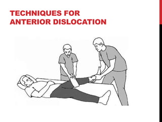 Hip Reduction Techniques | PPTX