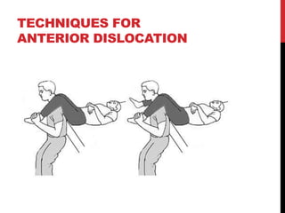 Hip Reduction Techniques | PPTX