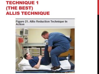 Hip Reduction Techniques | PPTX