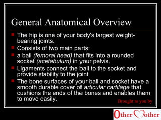 Hipreplacement 140718021057 Phpapp01 Pdf