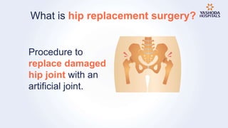Best hip replacement surgery hospitals in Hyderabad | Yashoda Hospitals ...