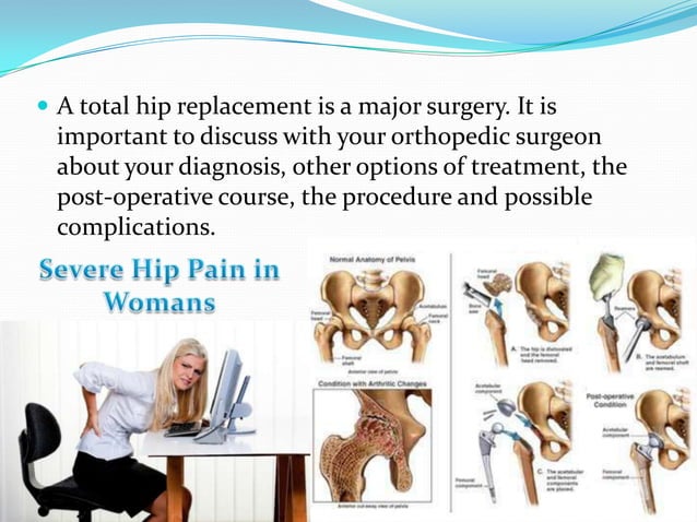 Hip replacement surgery India | PPTX