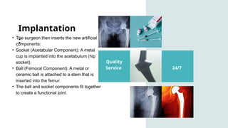 Hip Replacement Surgery Procedure-Dr Abhinav Kesarkar.pptx