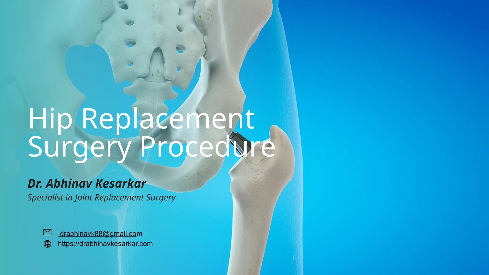 Hip Replacement Surgery Procedure-Dr Abhinav Kesarkar (1).pptx