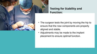 Hip Replacement Surgery Procedure-Dr Abhinav Kesarkar (1).pptx