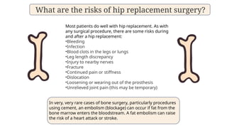 hip replacement, medicin, healthcare, surgery , | PPTX