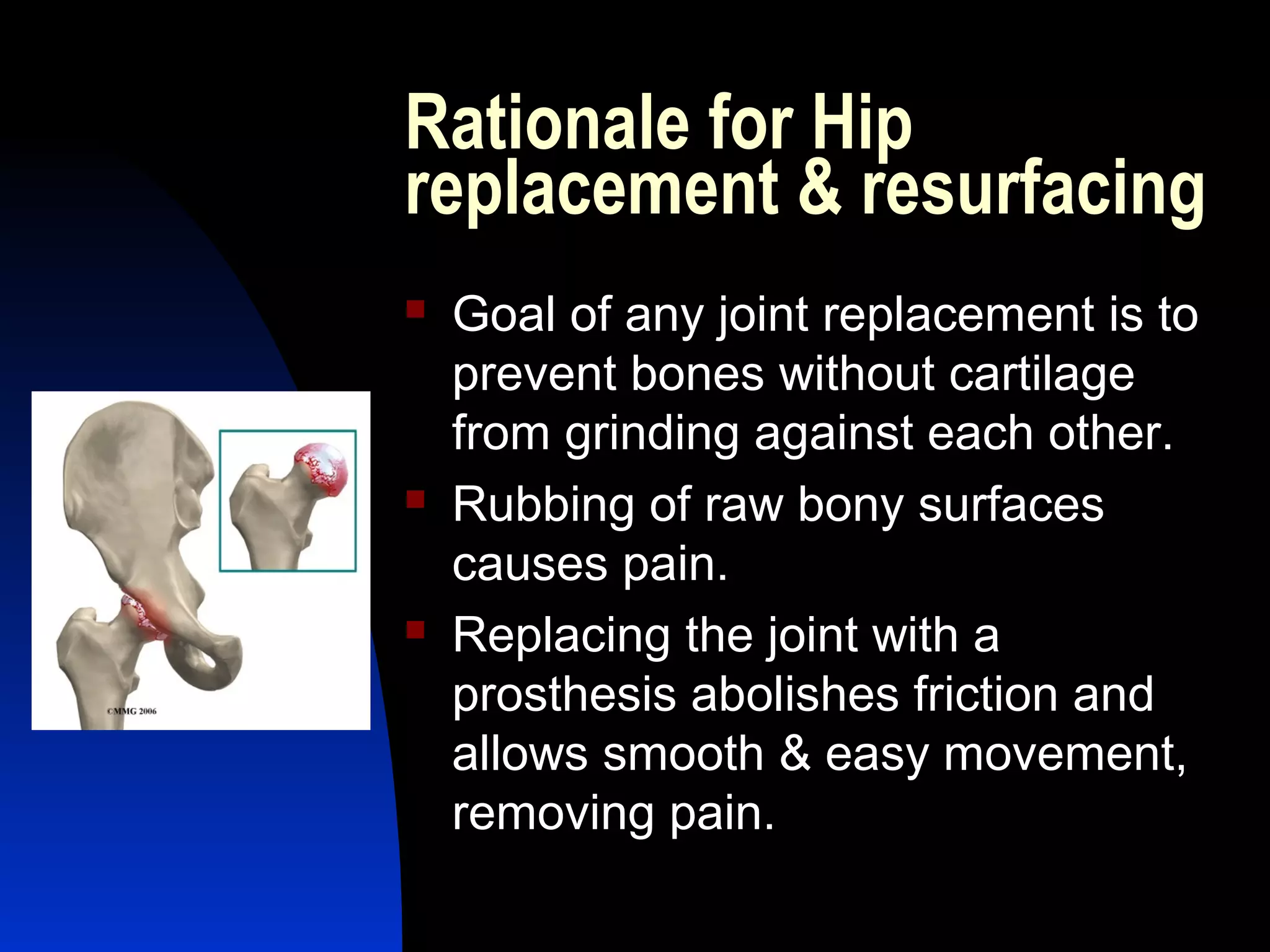 Hip Resurfacing in India Dr. Venkatachalam | PPT