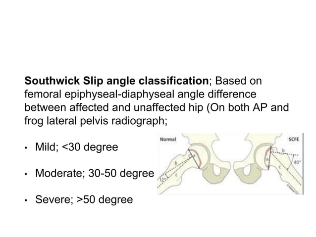 Slipped Capital Femoral Epiphysis (SCFE) | PPTX