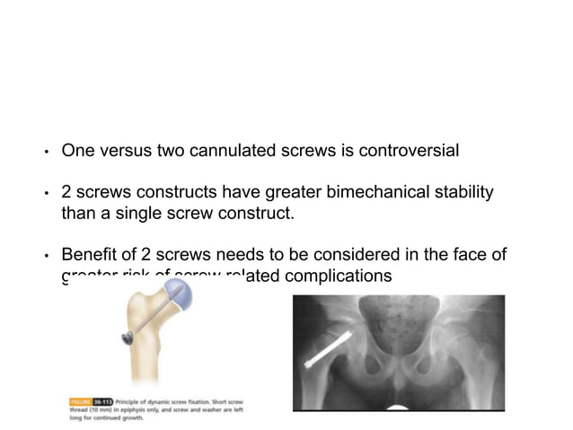 Slipped Capital Femoral Epiphysis (SCFE) | PPTX