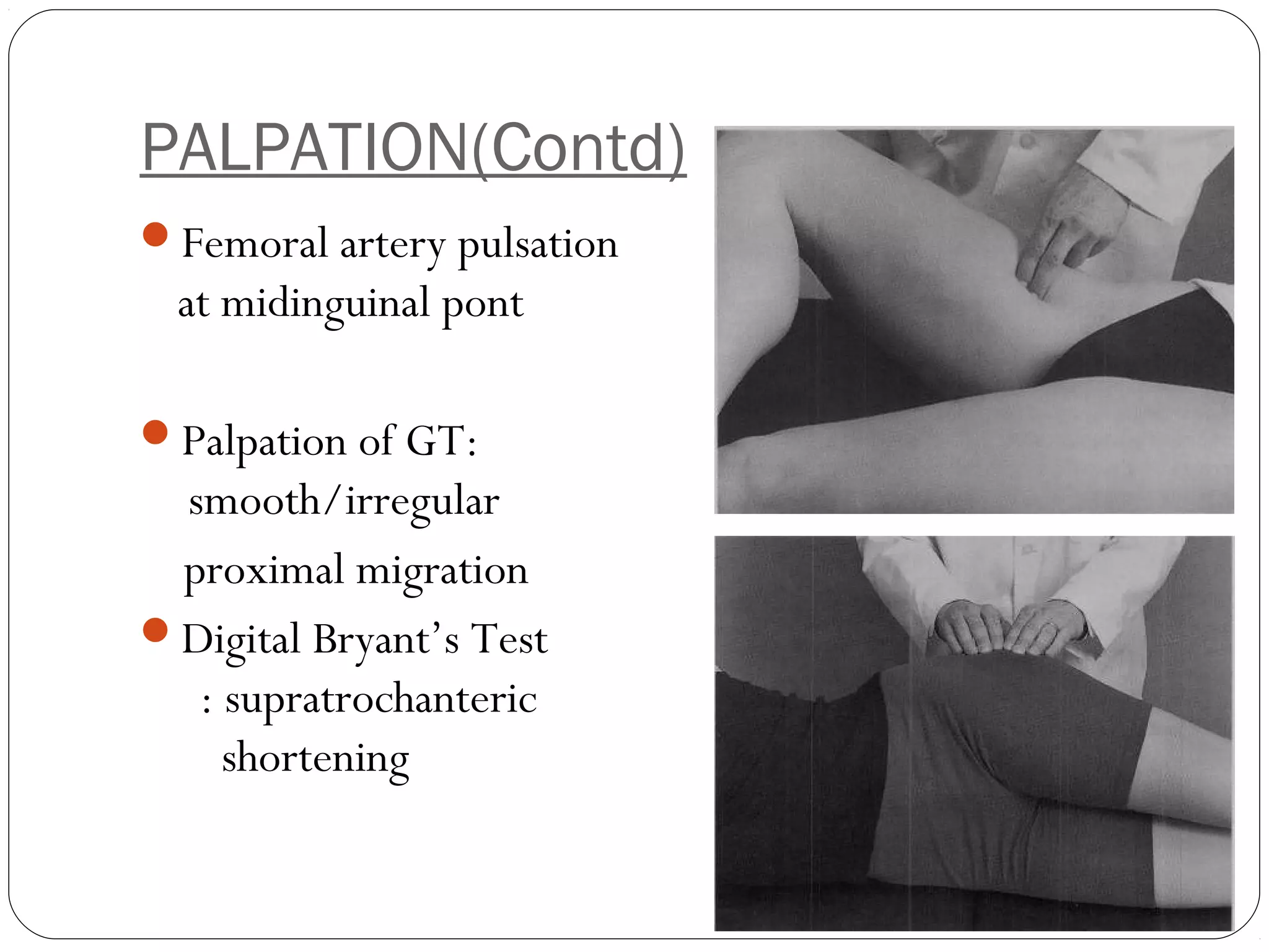 Clinical Examination of Hip | PPT