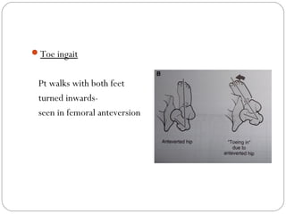 Clinical Examination of Hip | PPT