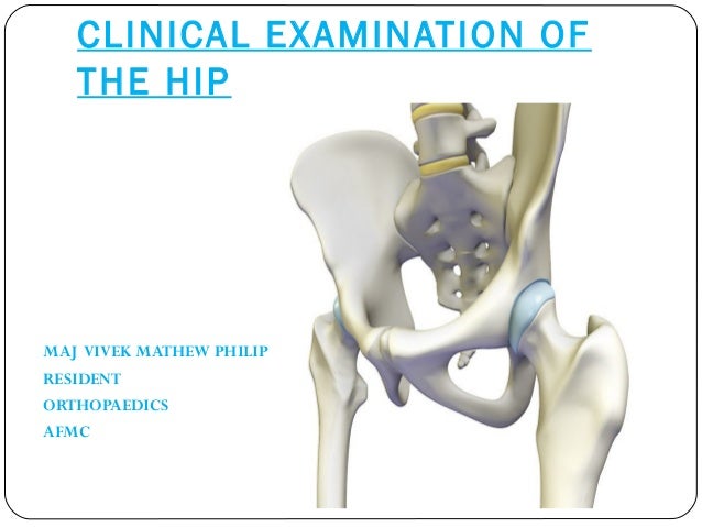 Clinical Examination of Hip