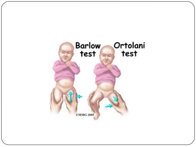 Clinical Examination of Hip
