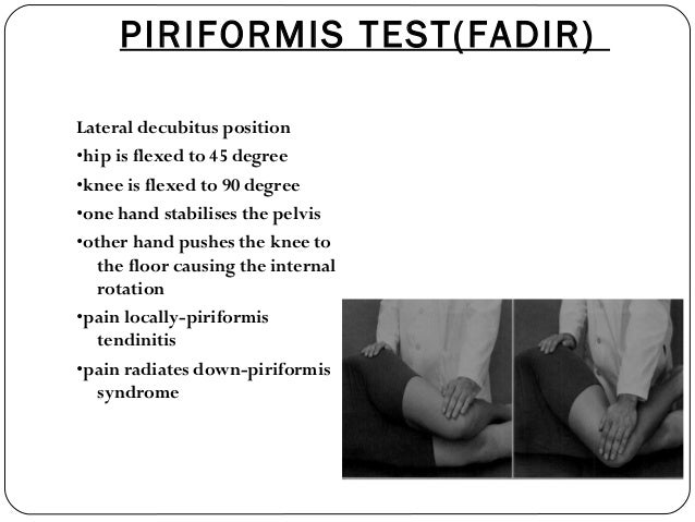 Clinical Examination of Hip
