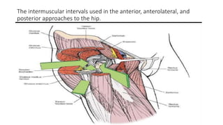 Hip surgical approach | PPTX