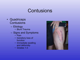 Thigh & Hip | PPT