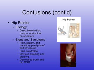 Thigh & Hip | PPT