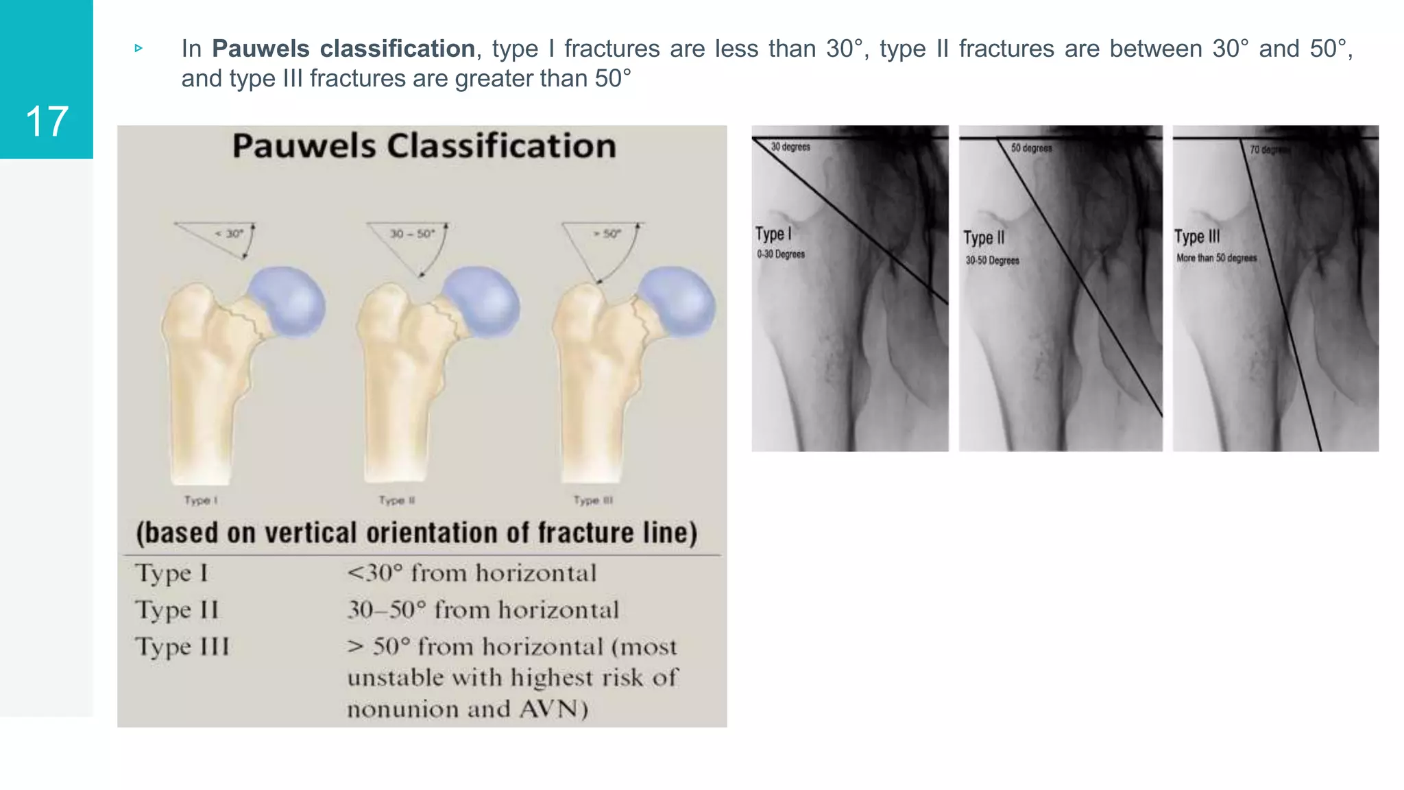 HIP X-RAY.pptx
