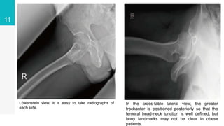 HIP X-RAY.pptx