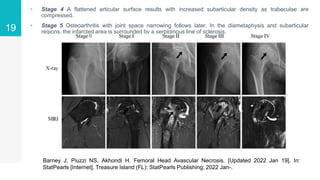 HIP X-RAY.pptx