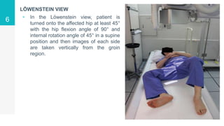 HIP X-RAY.pptx