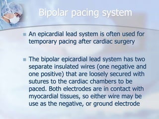 Pacemaker | PPT