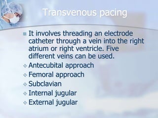 Pacemaker | PPT