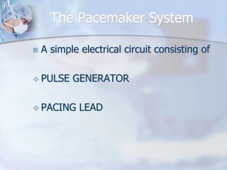 Pacemaker | PPT