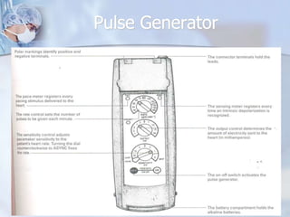 Pacemaker | PPT