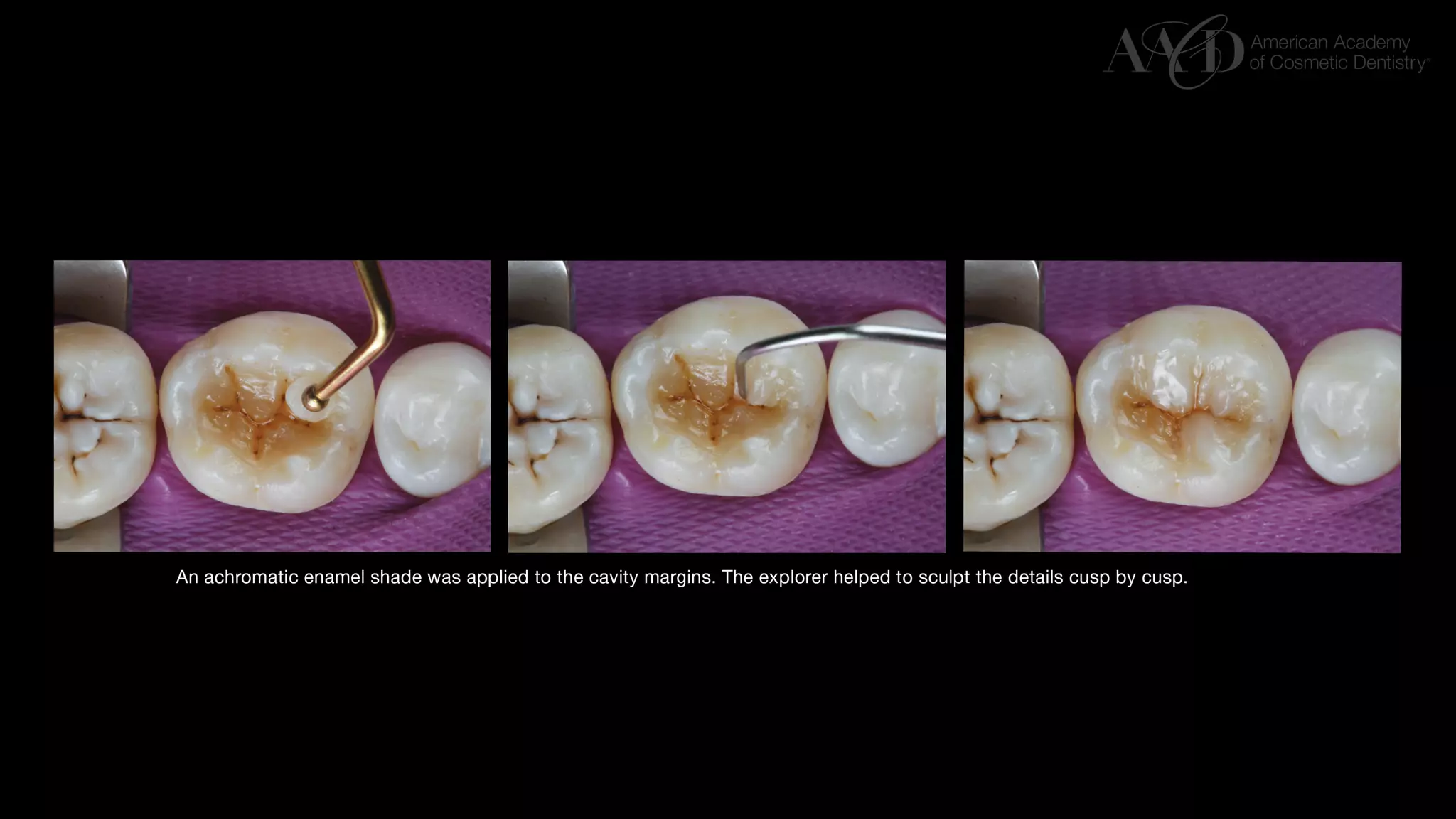 Traditional Layering vs. Modified Bulk Filling | PPT