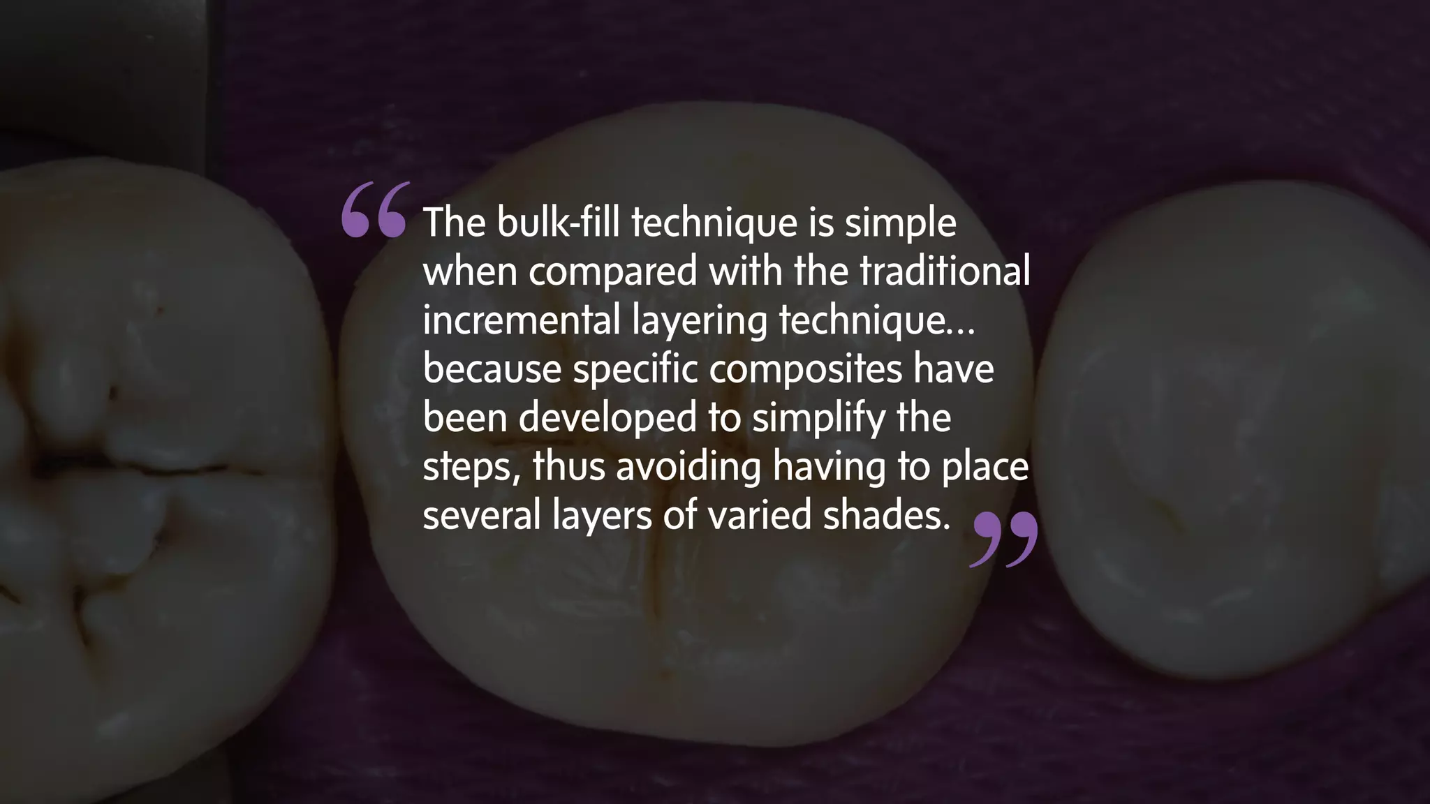 Traditional Layering vs. Modified Bulk Filling | PPT