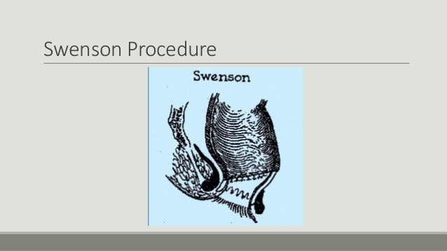 Hirdschsprug disease