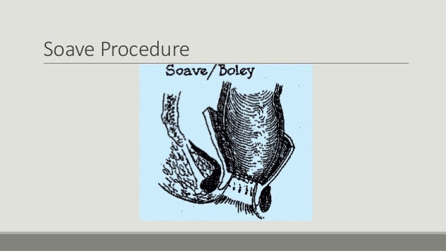 Hirdschsprug disease