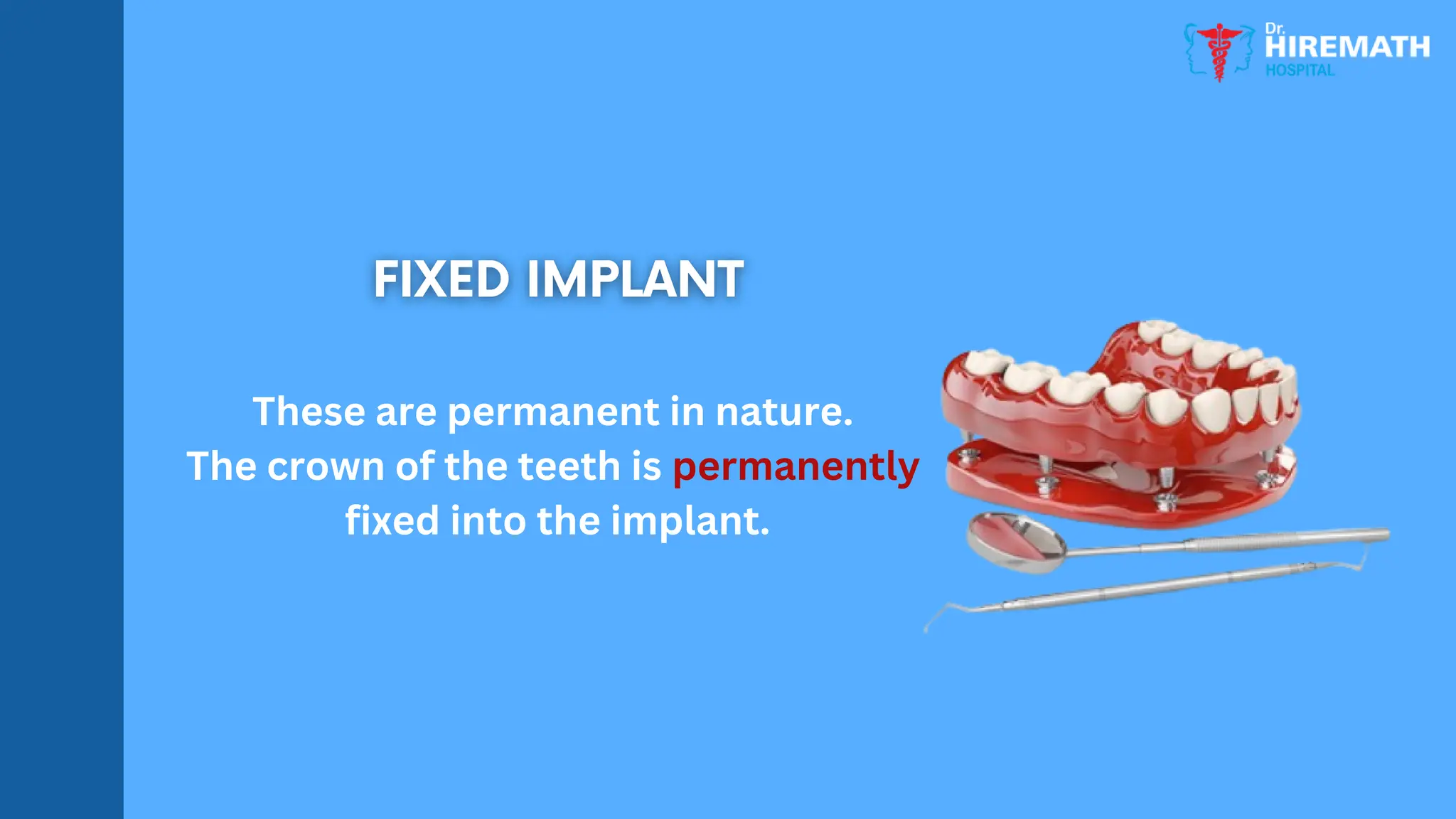 Types of Dental Implants- By Hiremath Hospital | PDF