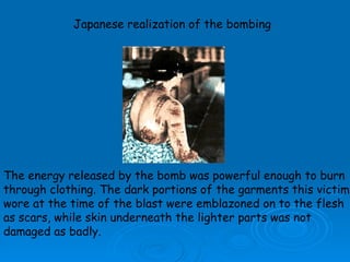 Hiroshima And Nagasaki | PPT